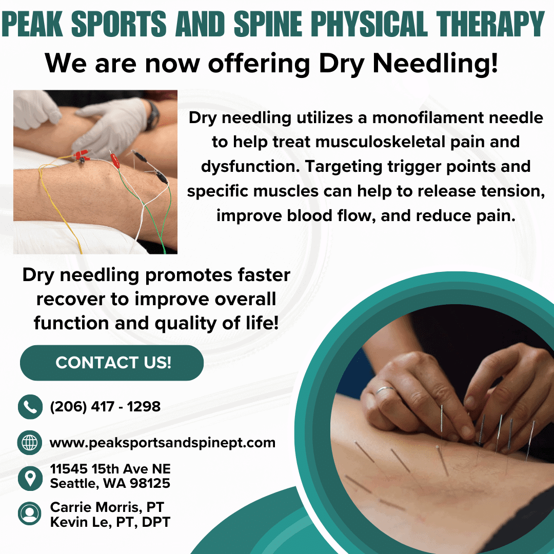 Trigger Point Dry Needling Peak Sports & Spine Lake City